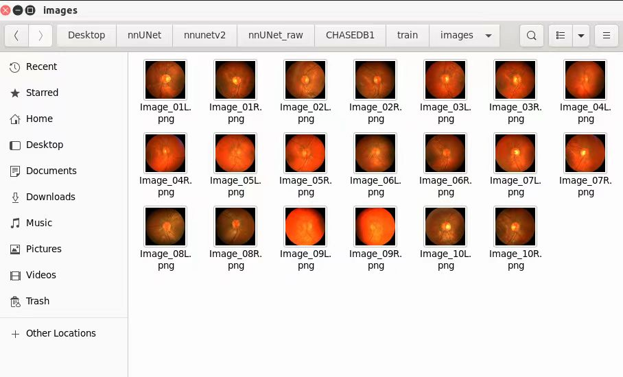 GitHub - ThreeStones1029/xray_nnunet